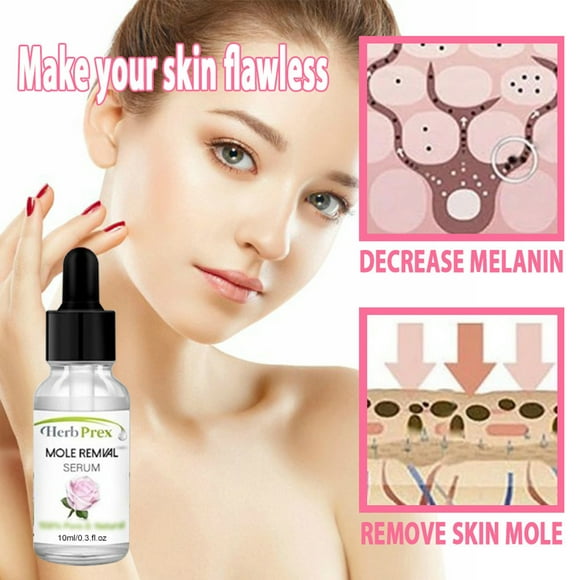 Best Mole Remover