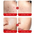 120ml X 1pc Soothing And Moisturizing Toner For Sensitive Skin With