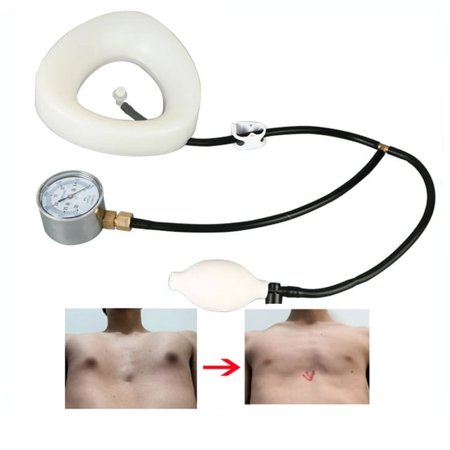 1Set Vacuum Bell Pectus Excavatum-Sternal Depression Support-Pectus ...