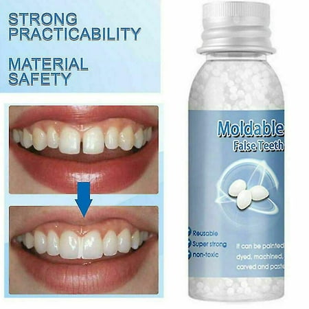 Tooth Repair Granules Temporary Tooth Repair Kit Fitting Beads Reusable ...