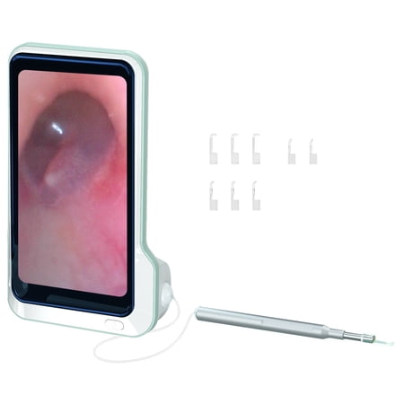 Smart Wifi with Screen Otoscope 5 Million 5.0 Inch HD Visual Ear Pick ...