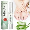 Xecvkr Revitalizing Nail Care Pens with Aloe & C, Two 4ml Solutions for ...