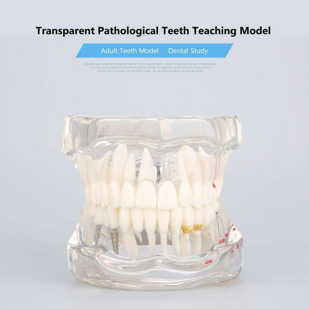Education Model, Detachable Tooth Model, Education Model, Disease Model ...