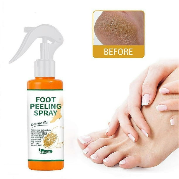 NEW Foot Peeling Spray Elbow Exfoliating Essence Pedicure Cosmetics ...