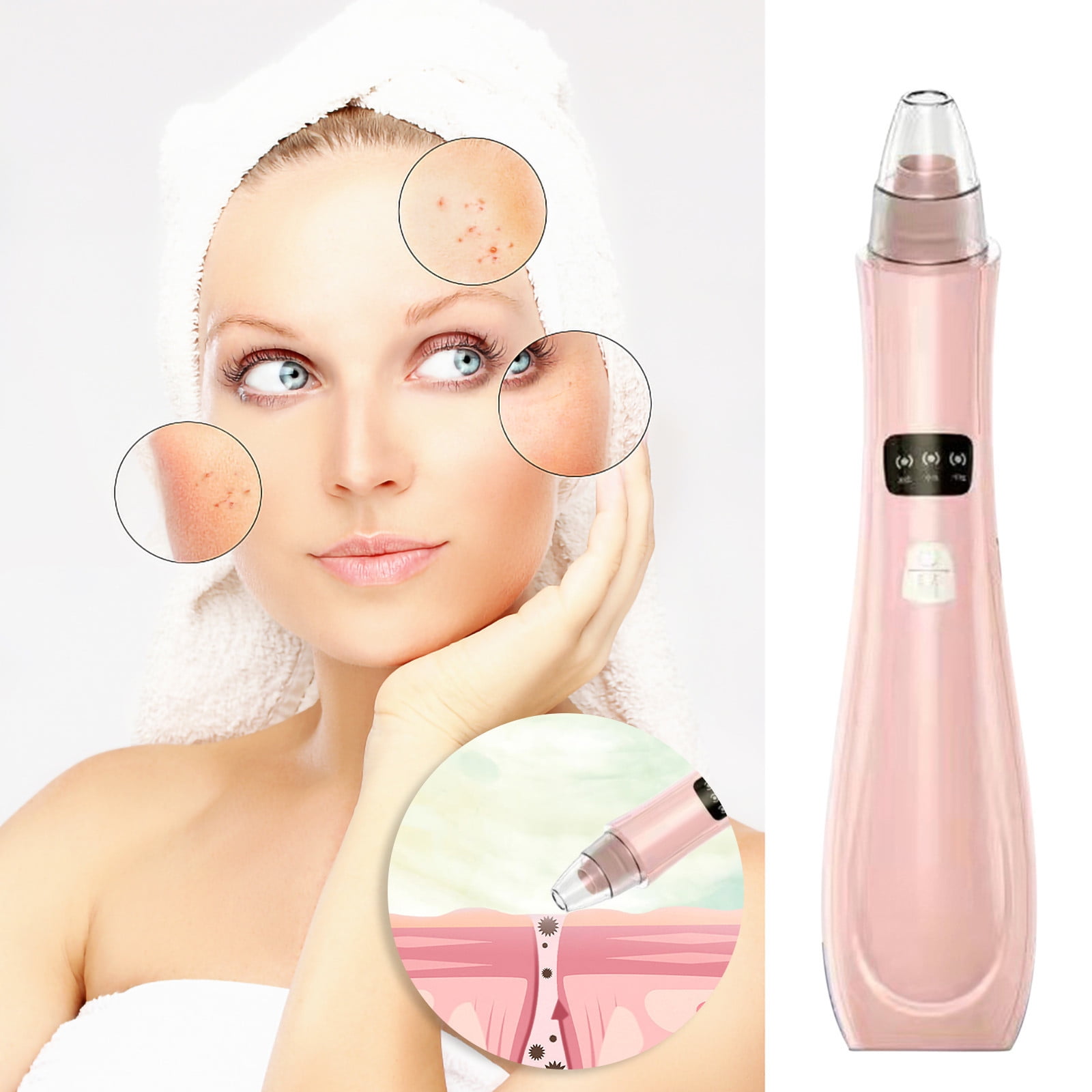 EJWQWQE USB Cleansing Face Electric Blackhead Removal Device Facial ...