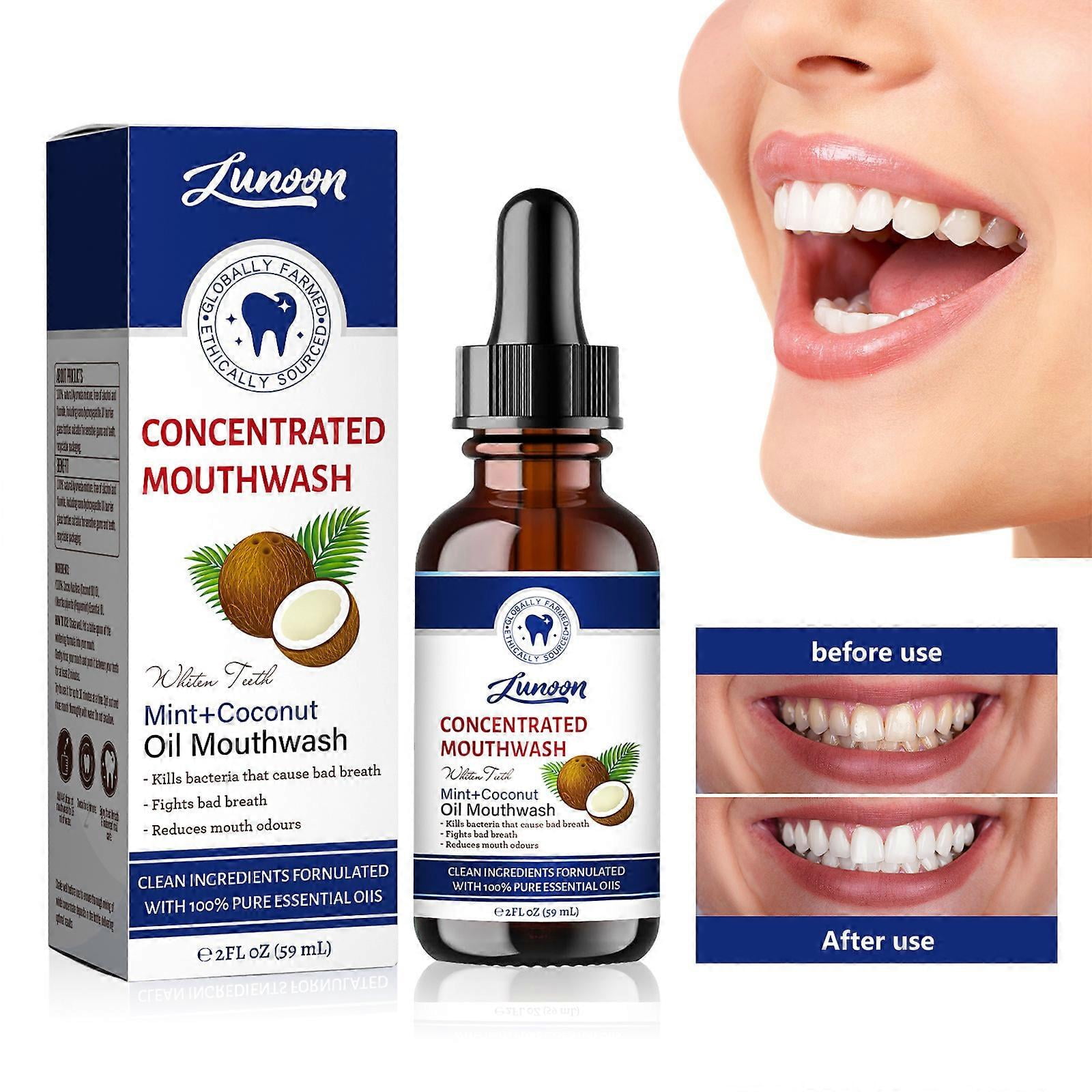 Enjuague bucal de coco 59ML elimina el mal aliento, elimina las manchas ...