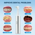 Flaremore Tooth Polisher, Rechargeable Dental Scaler with LED, Stain ...