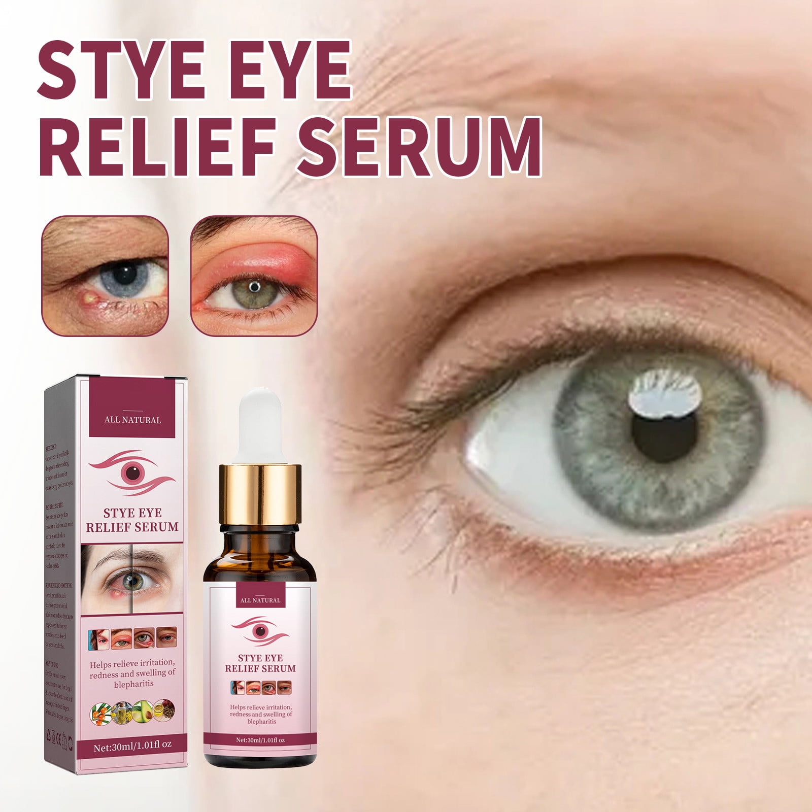 Click here for Lpsstore Eye Stye Remover Stye Eye Chalazion Remov... prices