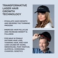 Hairmax FDA Cleared Laser Hair Growth Cap, Hair Loss & Regrowth ...