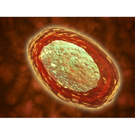 Microscopic view of samllpox. Smallpox is an acute contagious disease ...