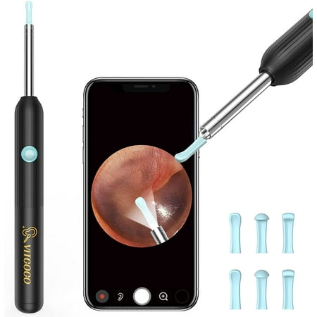 VITCOCO Ear Wax Remover, Wireless Ear Cleaner with 1920P Camera, 3.9mm ...