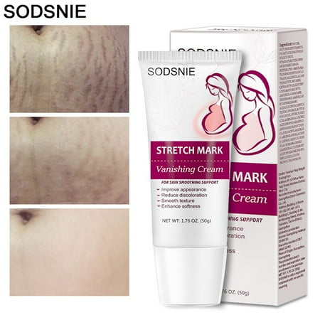 Burn Treatment: Burn & Scar Creams | Walmart Canada