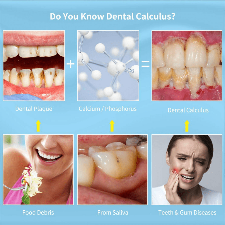 Black Calculus Teeth