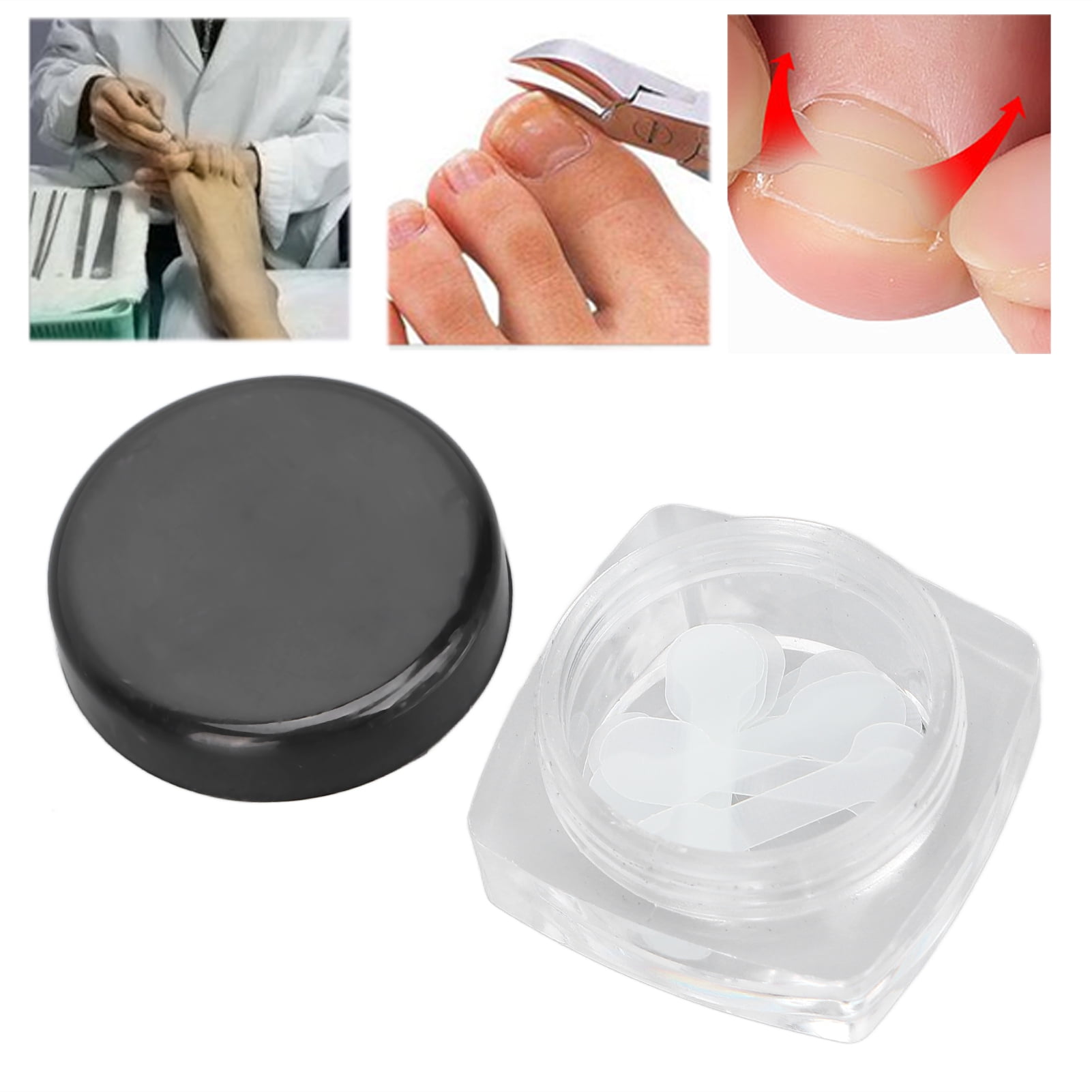 Click here for Estink 10pcs Ingrown Toe Nail Strips  Paronychia P... prices