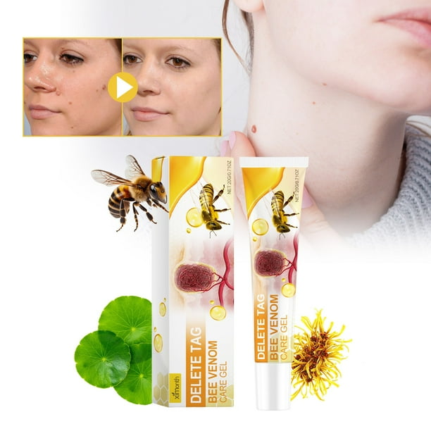 Clearance, Bee Relief Ointment, Bee Gel, And Bee Can Remove Skin ...
