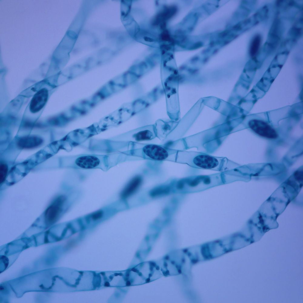 Spirogyra Under Microscope 100x
