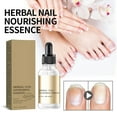 EKKIMIMI Nail Care Oil Hand And Foot Moisturizing Care And Thickening Nail Gray Nail Inlay Nail ...