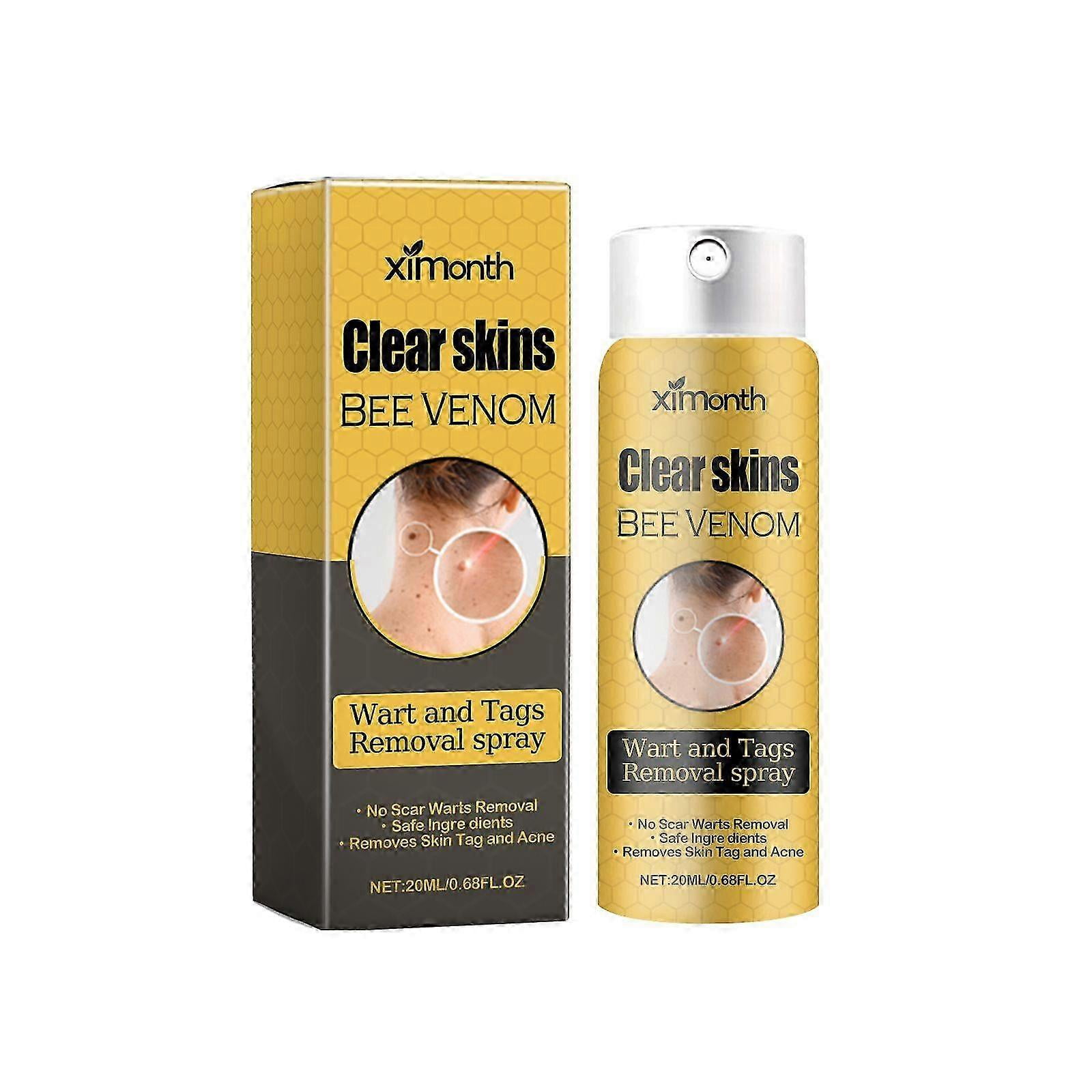 Wart And Tags Removal Spray, Cleanse And Fade Body Moles Smooth Skin ...
