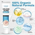 Keloid Bump Removal, Silicone Keloid Scar Removal Cream, Keloid Scar ...