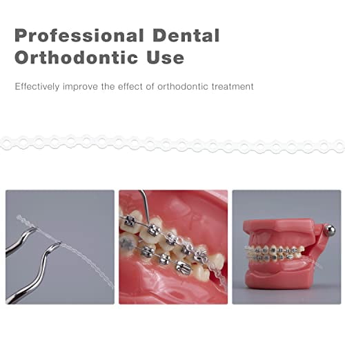 Braces Chain Rubber Bands