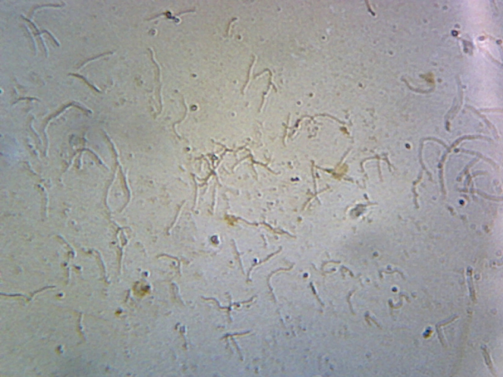 GSC International PS0325 Leptospira (Spirochetes); Smear - Walmart.com