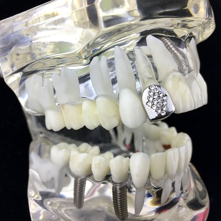 Best Grillz - Single Cap Grill Diamond-Shape Silver Tone One Tooth ...