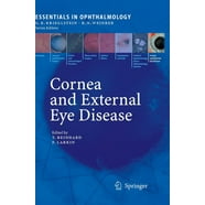 Essentials in Ophthalmology: Cataract and Refractive Surgery (Hardcover ...