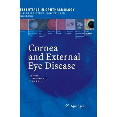 Essentials in Ophthalmology: Cataract and Refractive Surgery (Hardcover ...