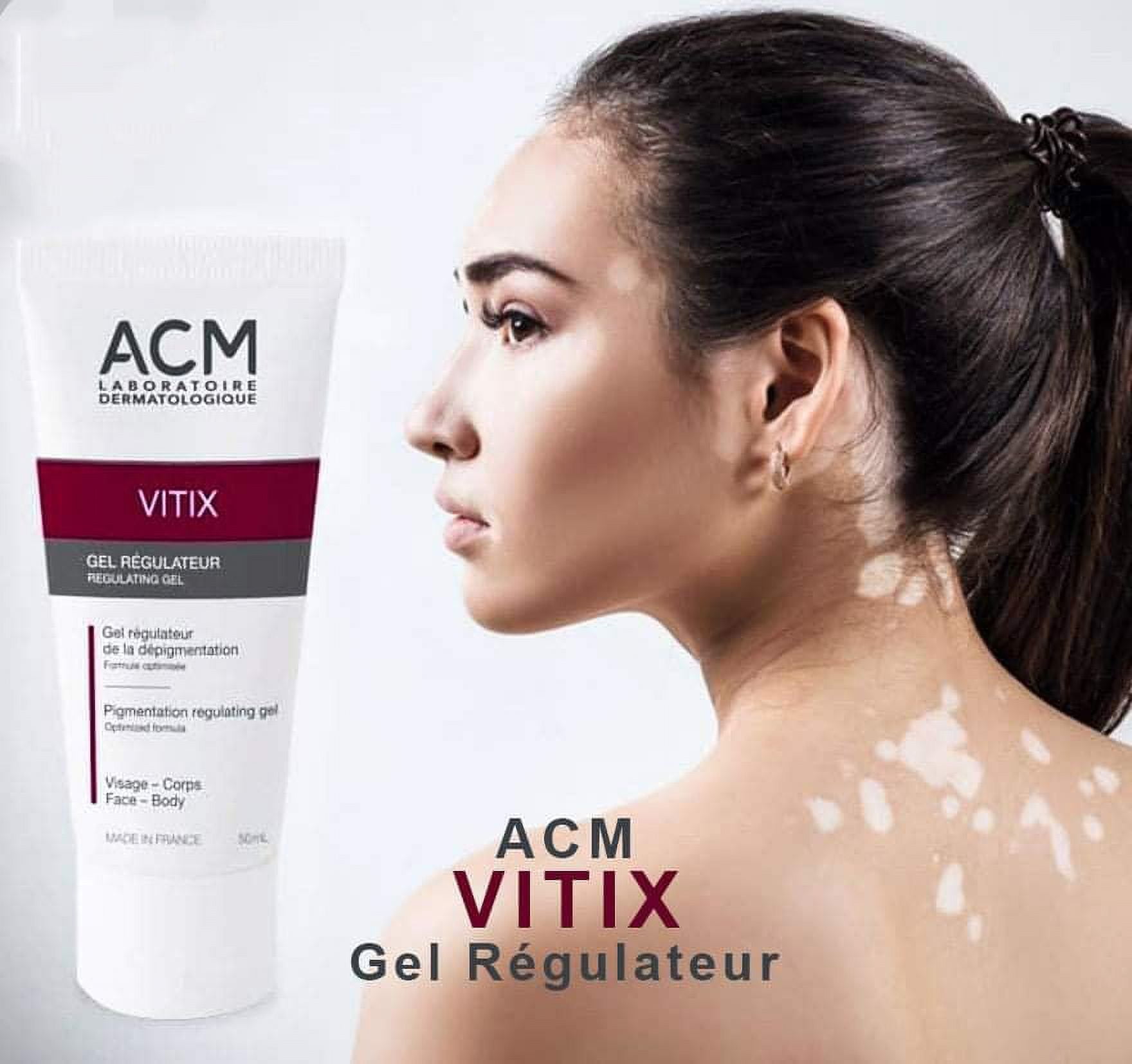 Vitix regulating gel para Vitiligo | Walmart en línea