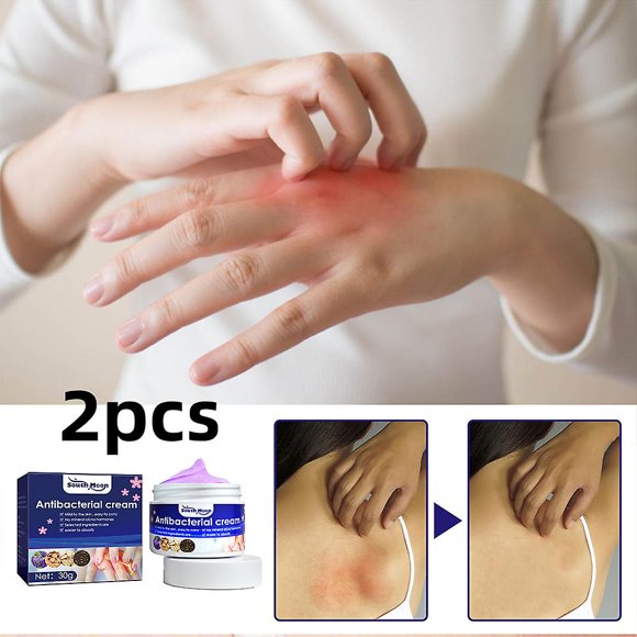 Anti Itch Cream | Walmart Canada