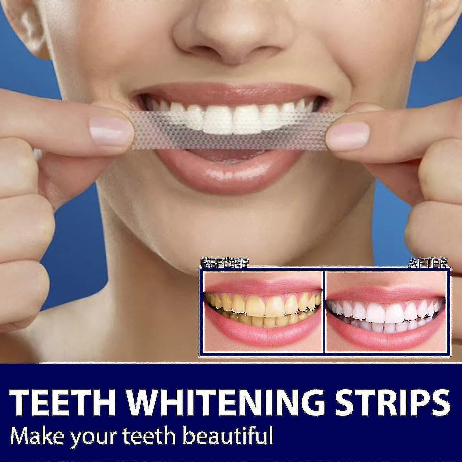 Eelhoe Teeth Remove Teeth Tartar Stains Toba -8126696317719 | Walmart ...