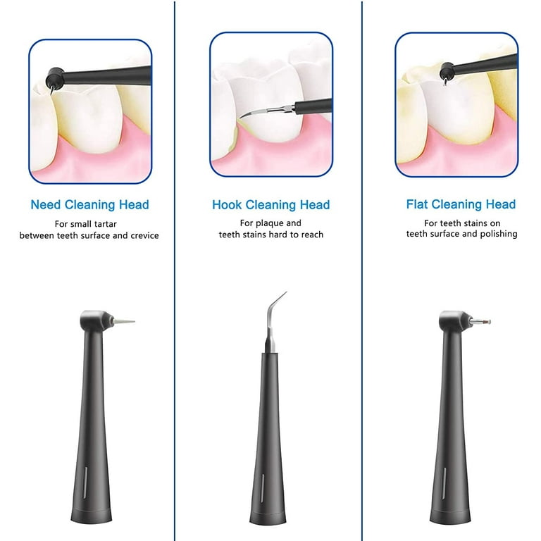 Dental Calculus Removal
