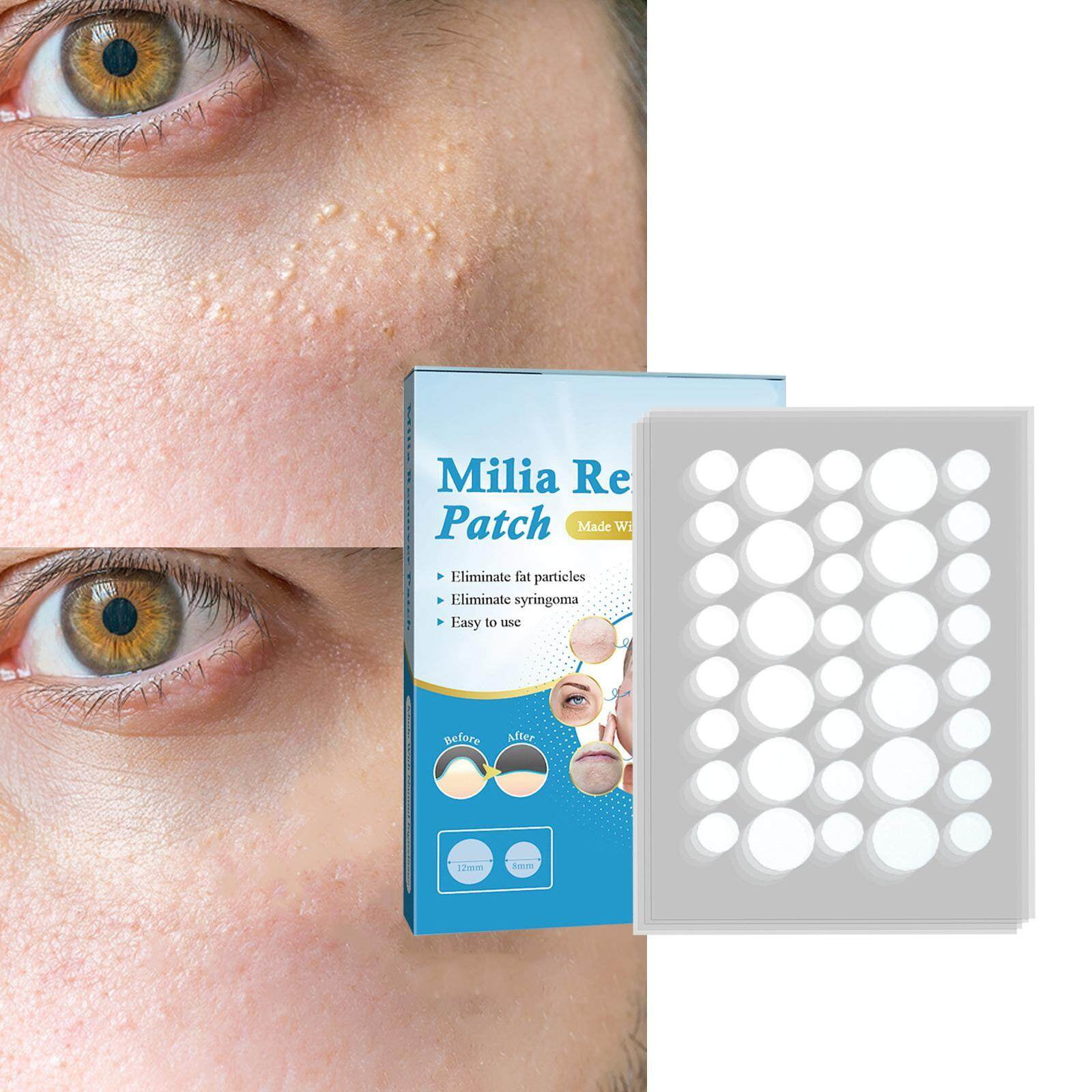 Click here for Tredstone Milia Remover Patch Sticker Moisturize C... prices