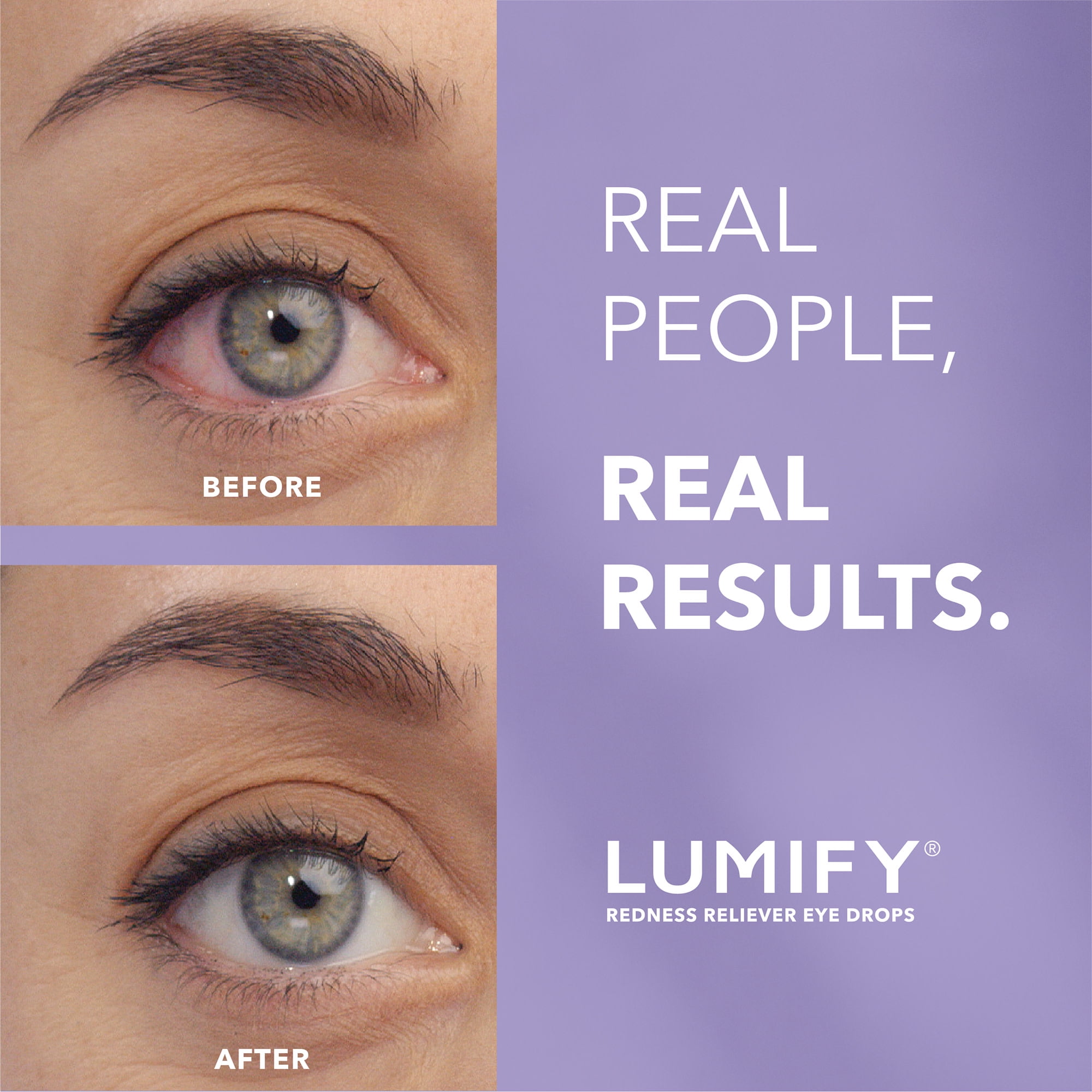 LUMIFY Eye Drops for Redness Relief and Whiter and Australia | Ubuy