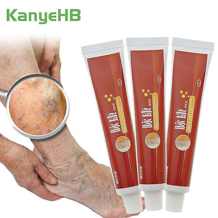 3pcs Varicose Veins Ointment Vasculitis Phlebitis Spider Cream Pain ...