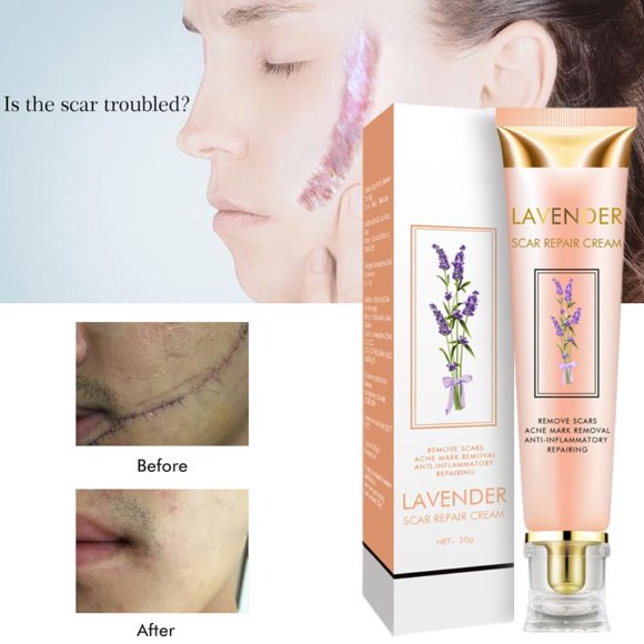 Burn Treatment: Burn & Scar Creams | Walmart Canada