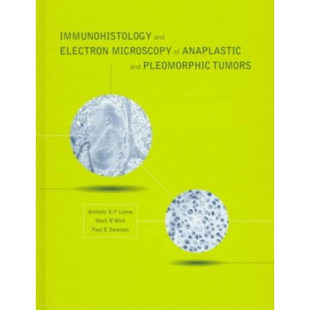 Immunohistology and Electron Microscopy of Anaplastic and Pleomorphic ...