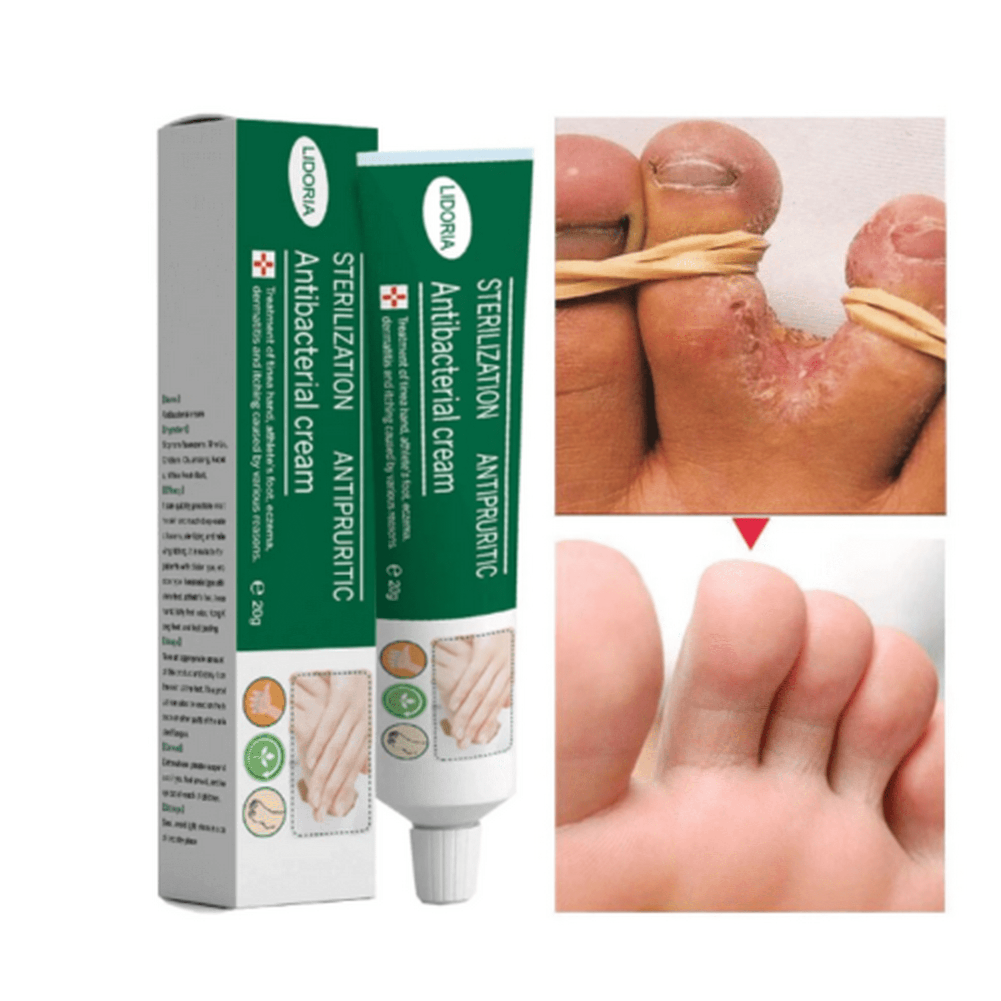 Click here for Wuwule Crema Para Eliminar Lo Hongo En Los Pies Al... prices