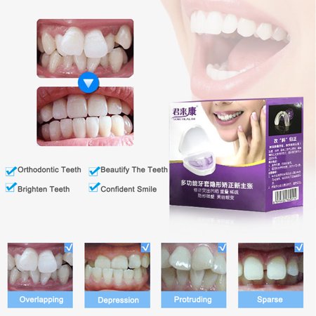 Dental Orthodontic Teeth Corrector Transparent Teeth Corrector; Teeth ...