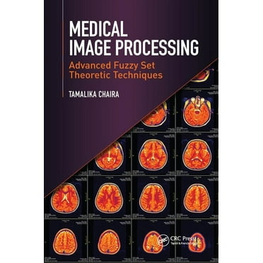 Image Processing with ImageJ - Second Edition (Paperback) - Walmart.com