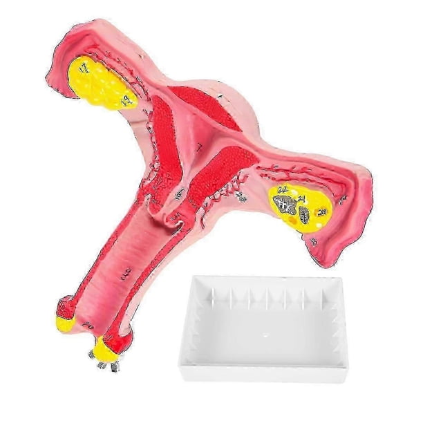 Life-Size Female Uterus Ovary Fallopian Tubes Model - Anatomical ...