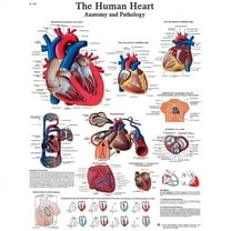 Fabrication B2138129 3B Anatomical Chart - Arthritis, Paper - Walmart.com