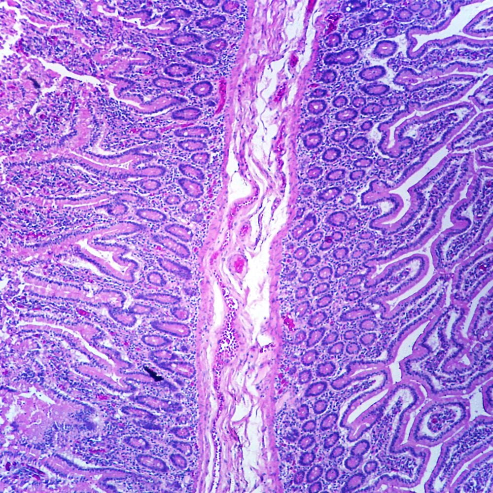 Duodenum Slide