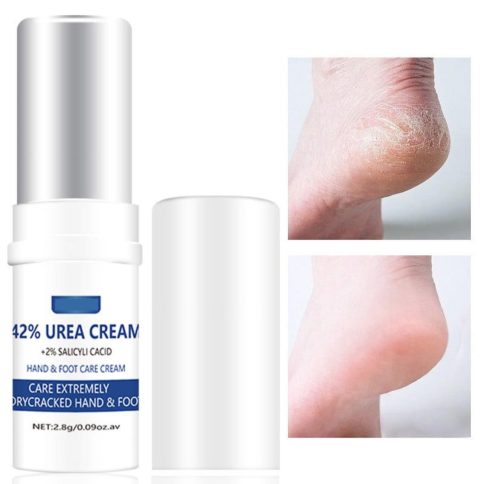 Puntoco Crema para pies secos y agrietados con retinol Heel Crema ...