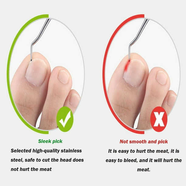 3-piece Gutter Special Nail Tongs Manicure Pedicure Incarceration ...