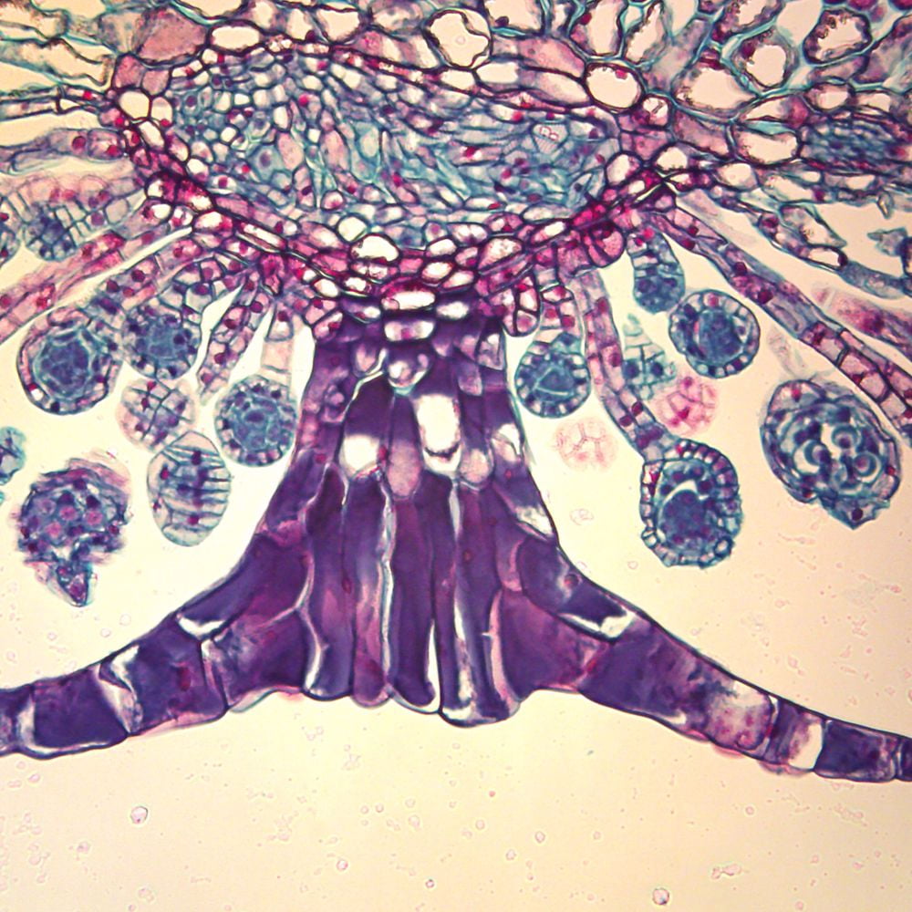 Fern Sporangia Slide