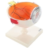 Axis Scientific 5X Enlarged Human Eye Model, Eyeball Anatomy, Multi ...