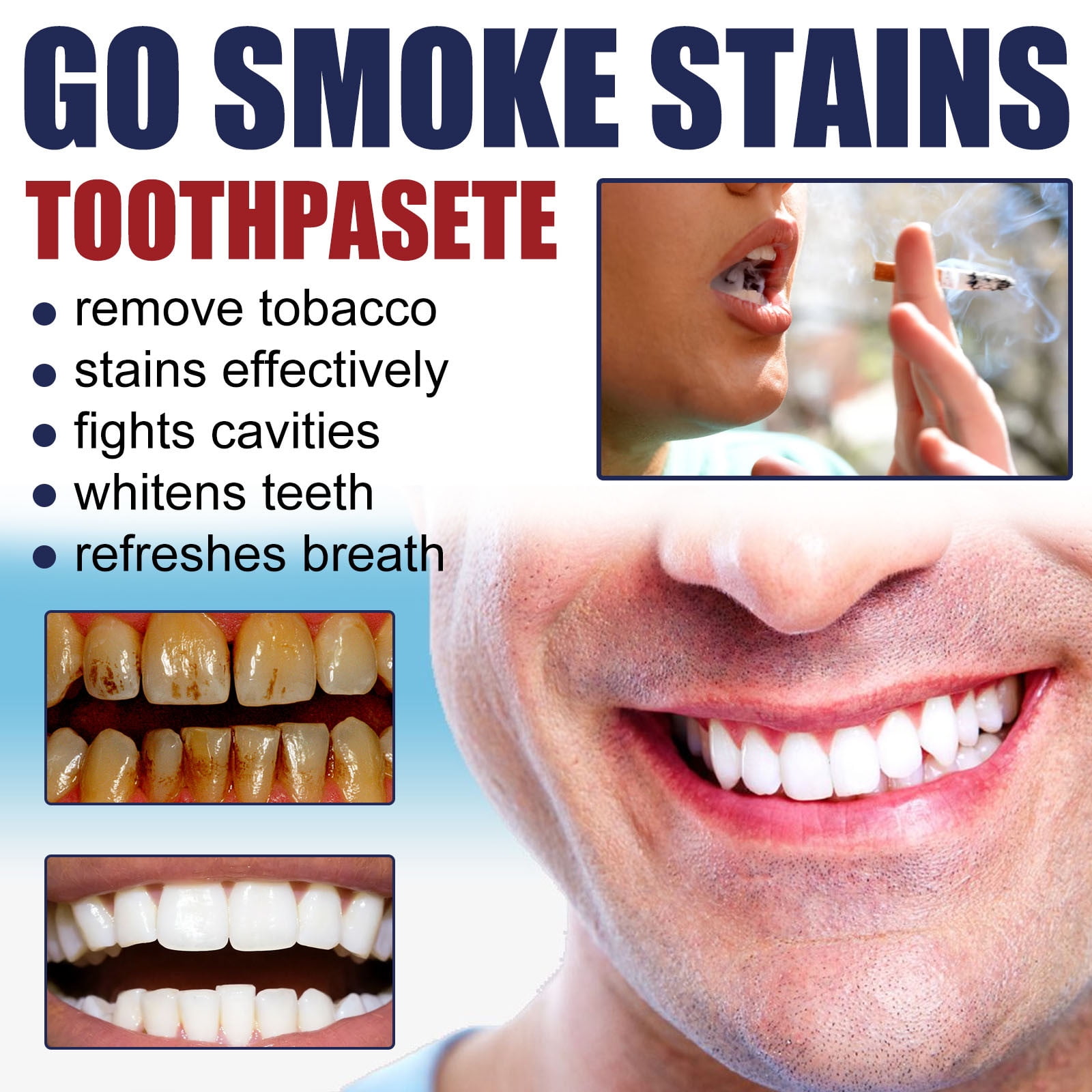 Stained Teeth From Smoking