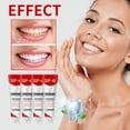 PURJKPU Sp-6 Ultra Whitening, Sp-6 Probiotic Whitening Toothpaste ...