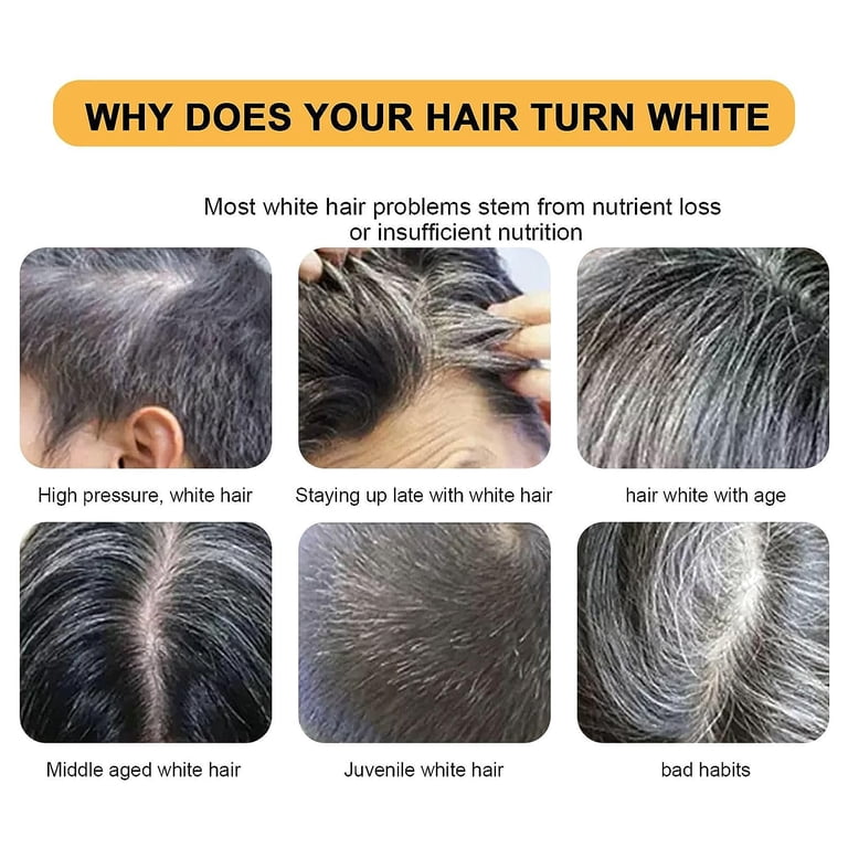 Mens Grey Hair Removal Hotsell | www.novaflex.se